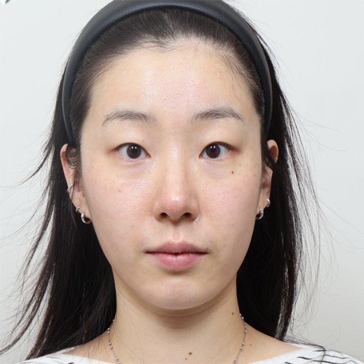 V・MOMENTクリニック｜狎鴎亭・清潭洞(ソウル)の美容医療・クリニック｜韓国旅行「コネスト」